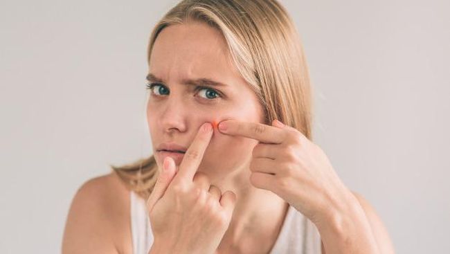 Punya Kulit Berjerawat? Ini Bahan yang Perlu Kamu Pakai Untuk Mengatasinya!