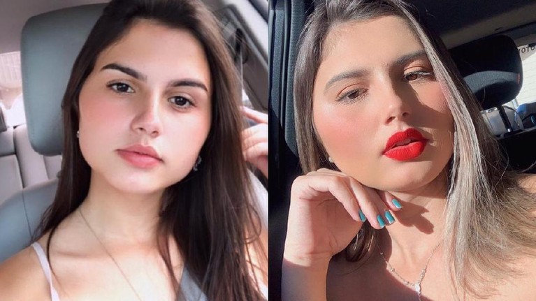 5 Potret Transgender Kembar Pertama di Dunia - Foto 1