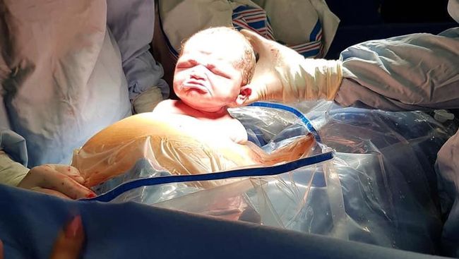 Dahulu Viral karena Lahir dengan Muka Cemberut, Ini Wajah Sang Bayi ...