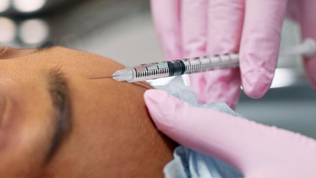 5 Fakta Suntik Botox: From A to Z!