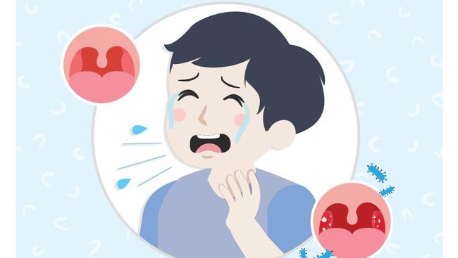 Gejala Amandel Anak Bengkak