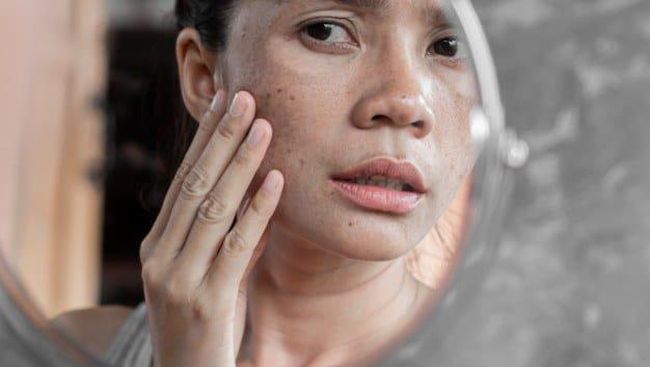 Waspada! Masih Sering Dilakukan, 6 Hal Ini Rupanya Bisa Memicu Noda ...