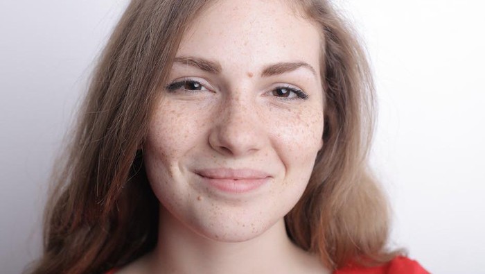 Simak Perbedaan Melasma dan Age Spots yang Sering Disalahpahami Orang Simak Perbedaan Melasma dan Age Spots yang Sering Disalahpahami Orang