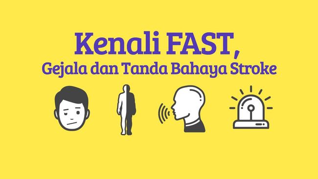 INFOGRAFIS: FAST, Gejala dan Tanda Bahaya Stroke
