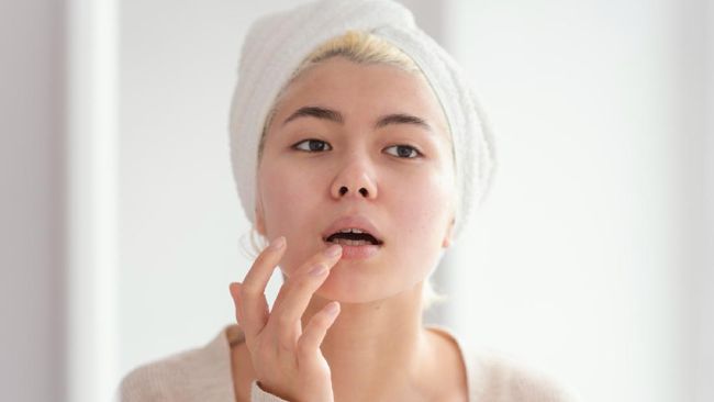 Bibir Merah Merona, Ternyata Begini Cara Merawatnya