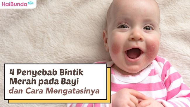 4 Penyebab Bintik Merah pada Bayi dan Cara Mengatasinya