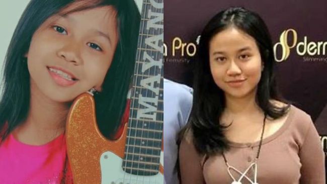 8 Potret Transformasi Mayang Usai Perawatan Wajah Rp80 Juta - Foto 1