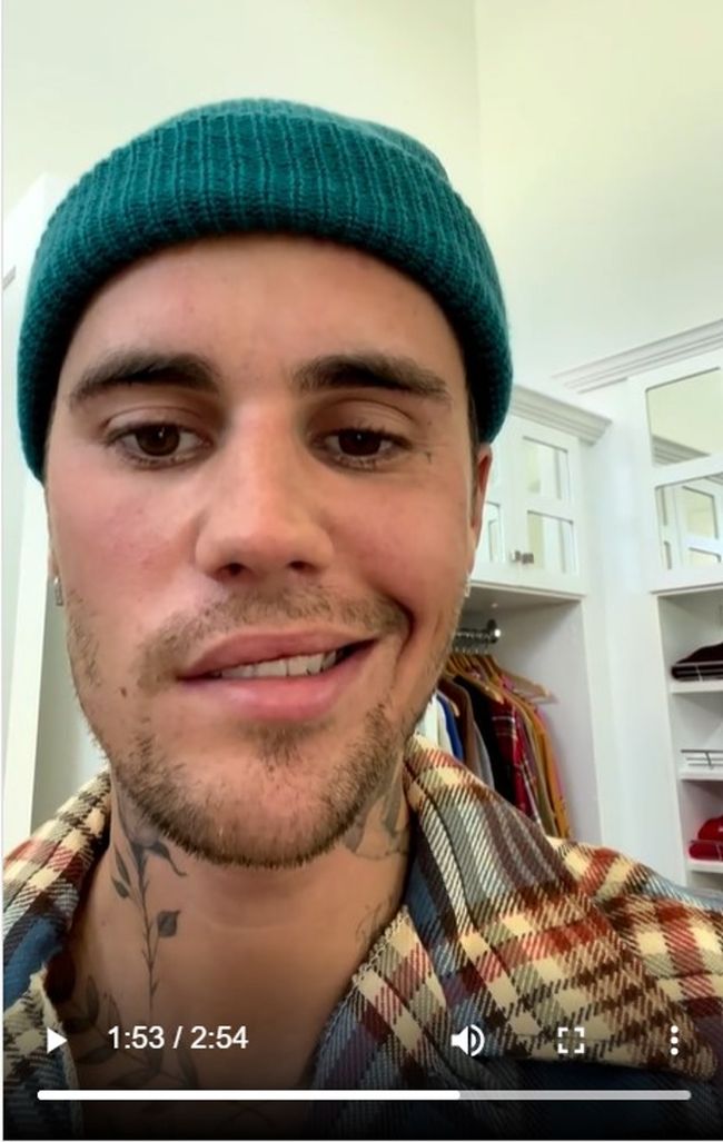 Picu Kelumpuhan Wajah Justin Bieber, Dokter Sebut Herpes Zoster Bisa ...