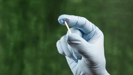 Panduan KB Implan : Fakta, Efek Samping, Harga, Cara Kerja dan Kelebihan