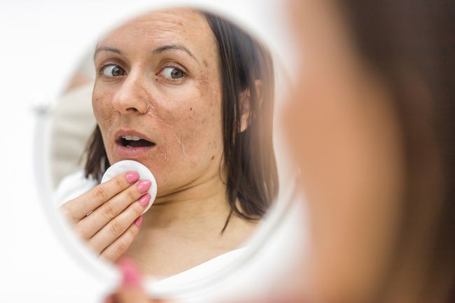 5 Bahan Skincare Berbahaya yang Bisa Merusak Kulit 5 Bahan Skincare Berbahaya yang Bisa Merusak Kulit