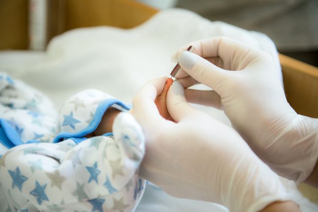Mengenal Skrining Hipotiroid Kongenital Shk Pada Bayi - vrogue.co Mengenal Skrining Hipotiroid Kongenital Shk Pada Bayi - vrogue.co