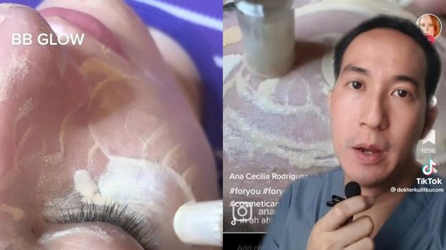 Viral di TikTok! Sulam Bedak Bikin Wajah Glowing Super Kilat, tapi Ini Bahayanya Menurut Dokter ...