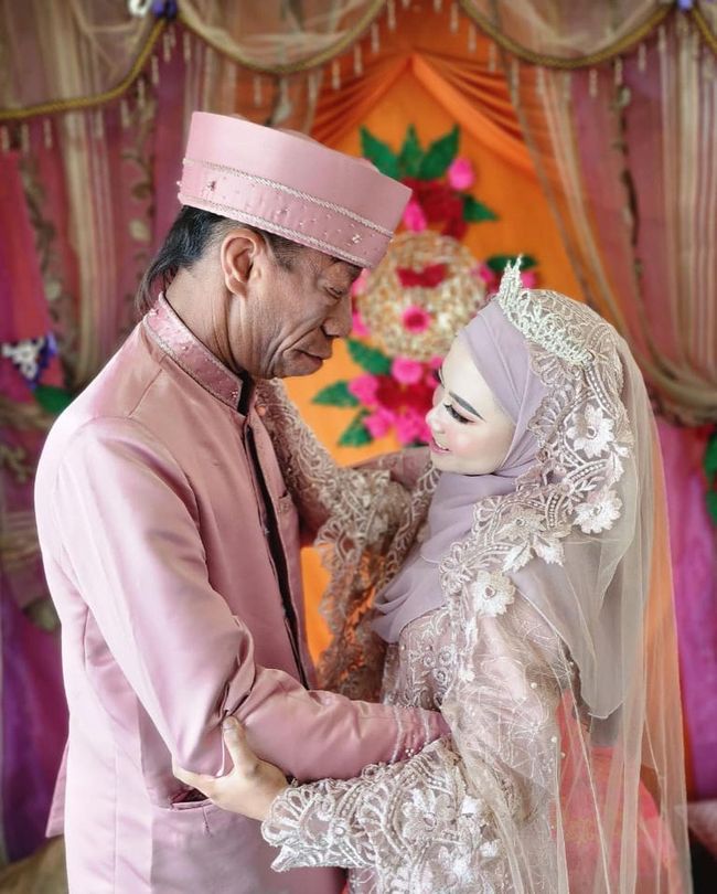 Mengidap Sindrom Langka, Surya Manurung Bersyukur Dapat Istri Berhati Tulus