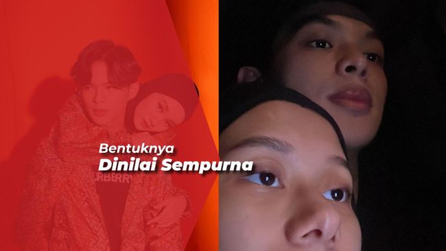 Dinda Hauw Dikira Operasi Plastik, Rey Mbayang: Istriku Hidungnya Original