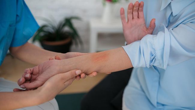 Cara Mengobati Gigitan Tomcat Di Wajah – iFaWorldCup.com