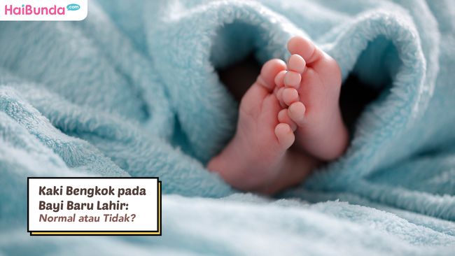 Kaki Bengkok pada Bayi Baru Lahir: Normal atau Tidak?