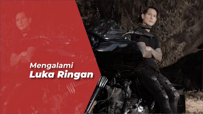 Kondisi Rombongan Moge Chef Juna usai Kecelakaan di Situbondo