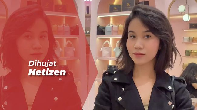 Mayang Sukses Operasi Hidung, Doddy: Makin Cantik Anak Daddy