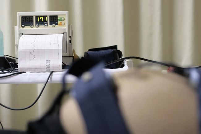 Cardiotocography (CTG)