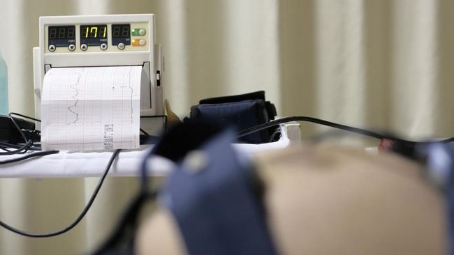 Mengenal Cardiotocography (CTG), Tes untuk Memantau Detak Jantung Janin