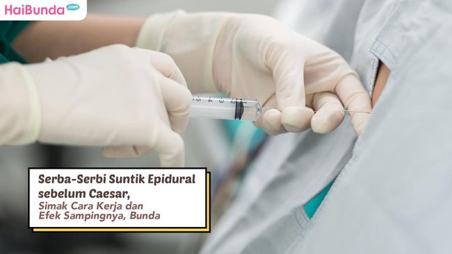 Serba-Serbi Suntik Epidural sebelum Caesar, Simak Cara Kerja dan Efek ...