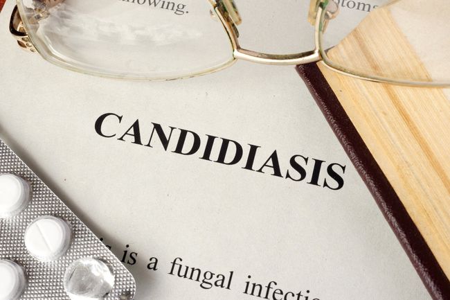 Kandidiasis: Jenis, Gejala, Penyebab, Pencegahan, dan Pengobatannya