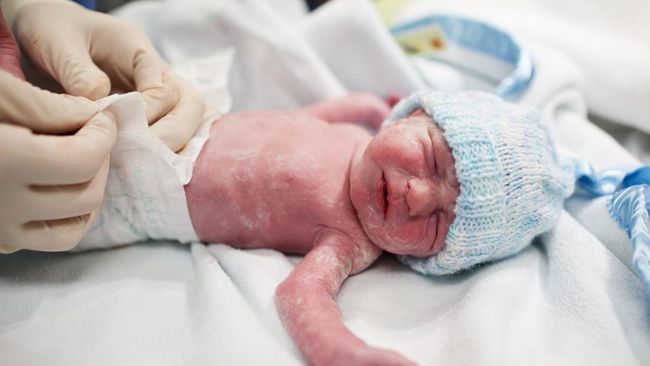 Vernix Caseosa Lapisan Putih yang Menyelimuti Bayi Saat Lahir, Apakah ...