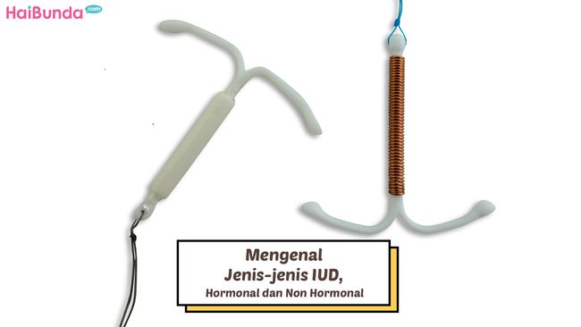 Mengenal Jenis-jenis IUD, Hormonal dan Non Hormonal