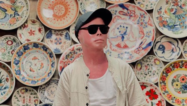 Koko Merah Sukses Bangun Bisnis Usai Idap Penyakit Langka