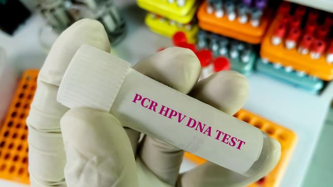 Skrining Kanker Serviks dengan HPV DNA Gratis di Jakarta, Bunda di Atas 30 Tahun Perlu Tahu