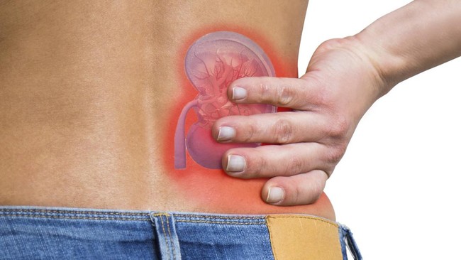 Sindikat Jual Beli Ginjal Bekasi Transplantasi Organ di RS Militer Sindikat Jual Beli Ginjal Bekasi Transplantasi Organ di RS Militer