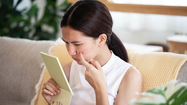 3 Perbedaan Jerawat Tanda Hamil dan Haid, Jangan Salah Kenali Ciri ...