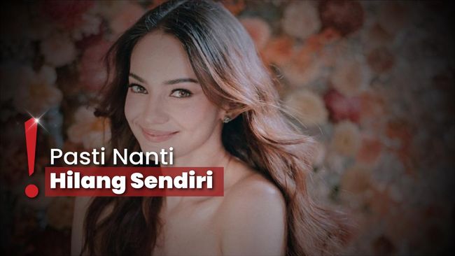 Molen Disebut Mirip Ragil Mahardika, Enzy Storia: Dia Nggak Main Medsos