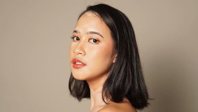 Kisah Dokter Salma Kyana yang Mendadak Alami Vitiligo, Kini Jadi Puteri ...