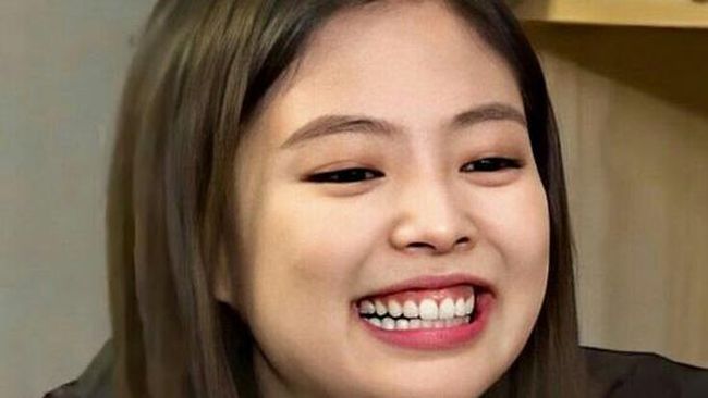 Mengenal 4 Penyebab Gummy Smile yang Terkadang Membuat Sebagian Orang ...