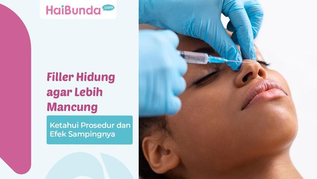 Filler Hidung agar Lebih Mancung, Ketahui Prosedur dan Efek Sampingnya