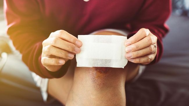 7 Tahap Pertolongan Pertama Kaki Luka Akibat Jatuh dari Motor