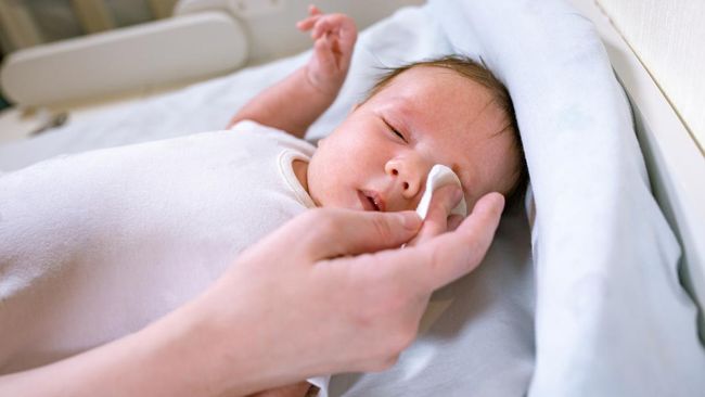 Penyebab Mata Bayi Baru Lahir Belekan Terus, Bahayakah untuk Kesehatannya?