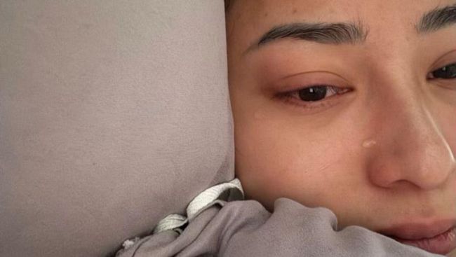 7 Potret Kondisi Nikita Willy Usai Alami Keguguran di Kehamilan Anak Kedua