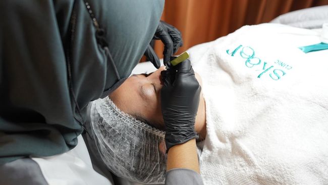 Tampil dengan Wajah Baru, Skaer Aesthetic & Acupuncture Clinic Hadirkan ...