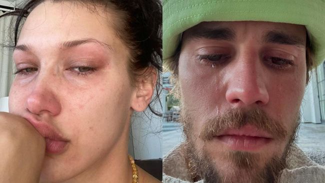 Crying Selfie Marak di Instagram dan TikTok, Bentuk Validasi atau ...