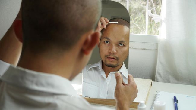Rambut Botak Depan Tanda Alami Gangguan Kesuburan, Simak Faktanya!