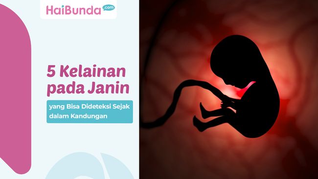 5 Kelainan pada Janin yang Bisa Dideteksi Sejak dalam Kandungan