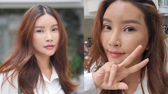 Penampilan Terbaru Sarwendah Hasil Operasi Plastik di Korea