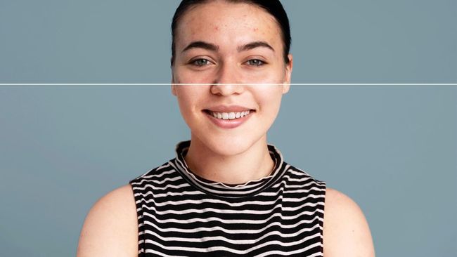 Jangan Asal Pakai, Ini 6 Perubahan Kulit Wajah Tanda Tak Cocok dengan ...