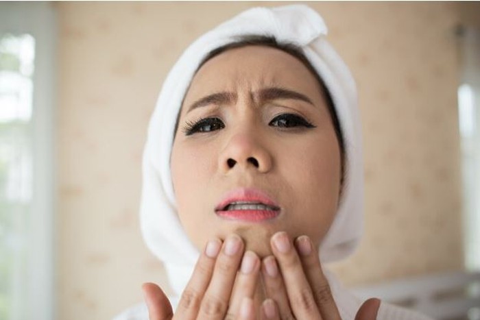 4 Kebiasaan Yang Menjadi Penyebab Bekas Jerawat Susah Hilang Kamu