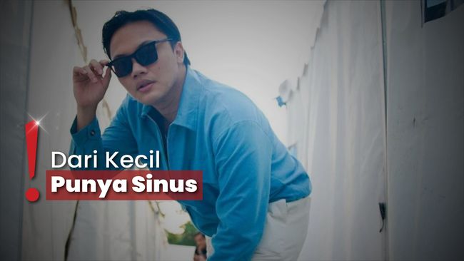 Tampilan Wajah Terbaru Rizky Febian yang Diduga Oplas Bareng Mahalini