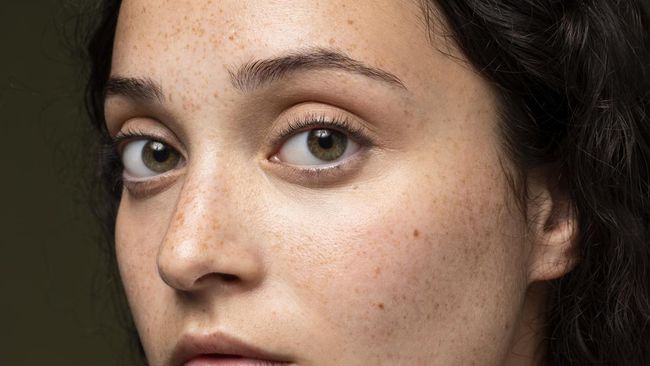 Ini Penyebab dan Cara Menghilangkan Bintik Hitam di Wajah yang Aman ...