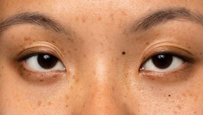 Usir Noda Hitam dan Kulit Kusam, Ini 3 Bahan Ajaib yang Harus Ada di ...