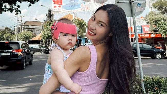 5 Potret Zoe Bertoli Anak Patricia Gouw Pakai Helm Anti Peyang, Terbaru Check Up ke Singapura ...